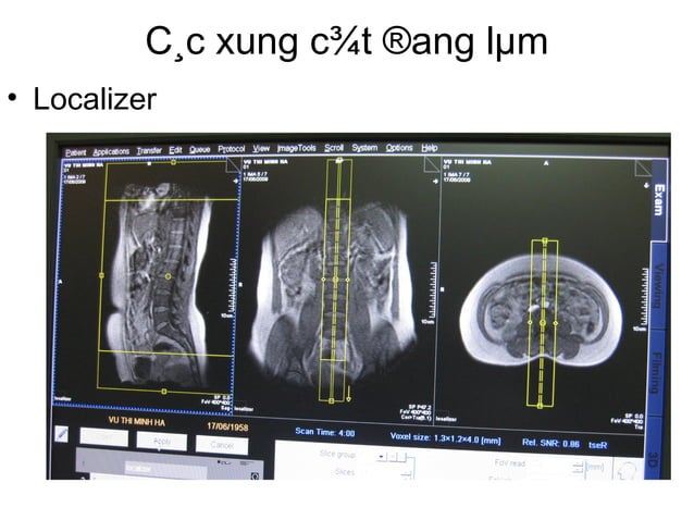 Ky thuat chup mri cstl | PPT