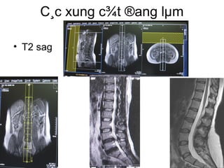 Ky thuat chup mri cstl | PPT