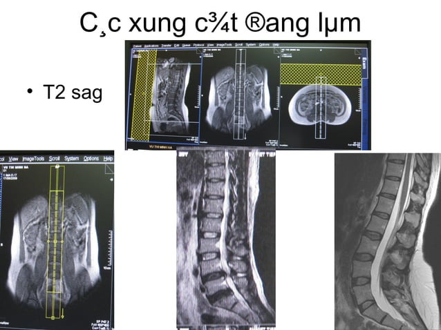Ky thuat chup mri cstl | PPT