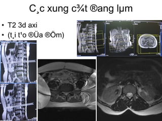 Ky thuat chup mri cstl | PPT