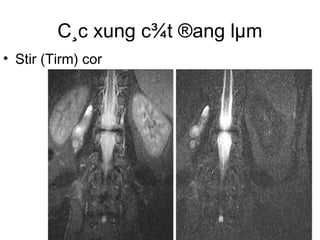 Ky thuat chup mri cstl | PPT