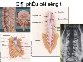 Ky thuat chup mri cstl | PPT