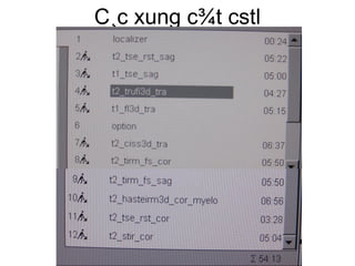 Ky thuat chup mri cstl | PPT