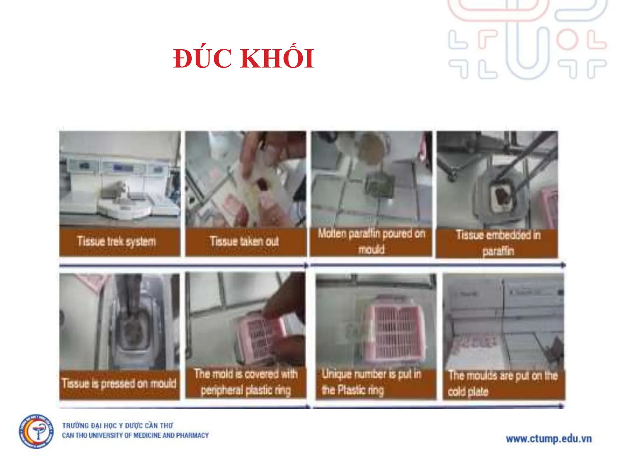 KY THUAT GIAI PHAU BENH PPT - HISTOPATHOLOGY TECHNIQUES - PATHOLOGY CTUMP NGUYEN PHUC DUY 2023 ...