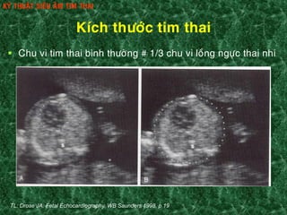 KỸ THUẬT SIÊU ÂM TIM THAI | PDF