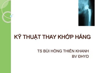 KY THUAT thay khớp háng- bs Khanh.ppt