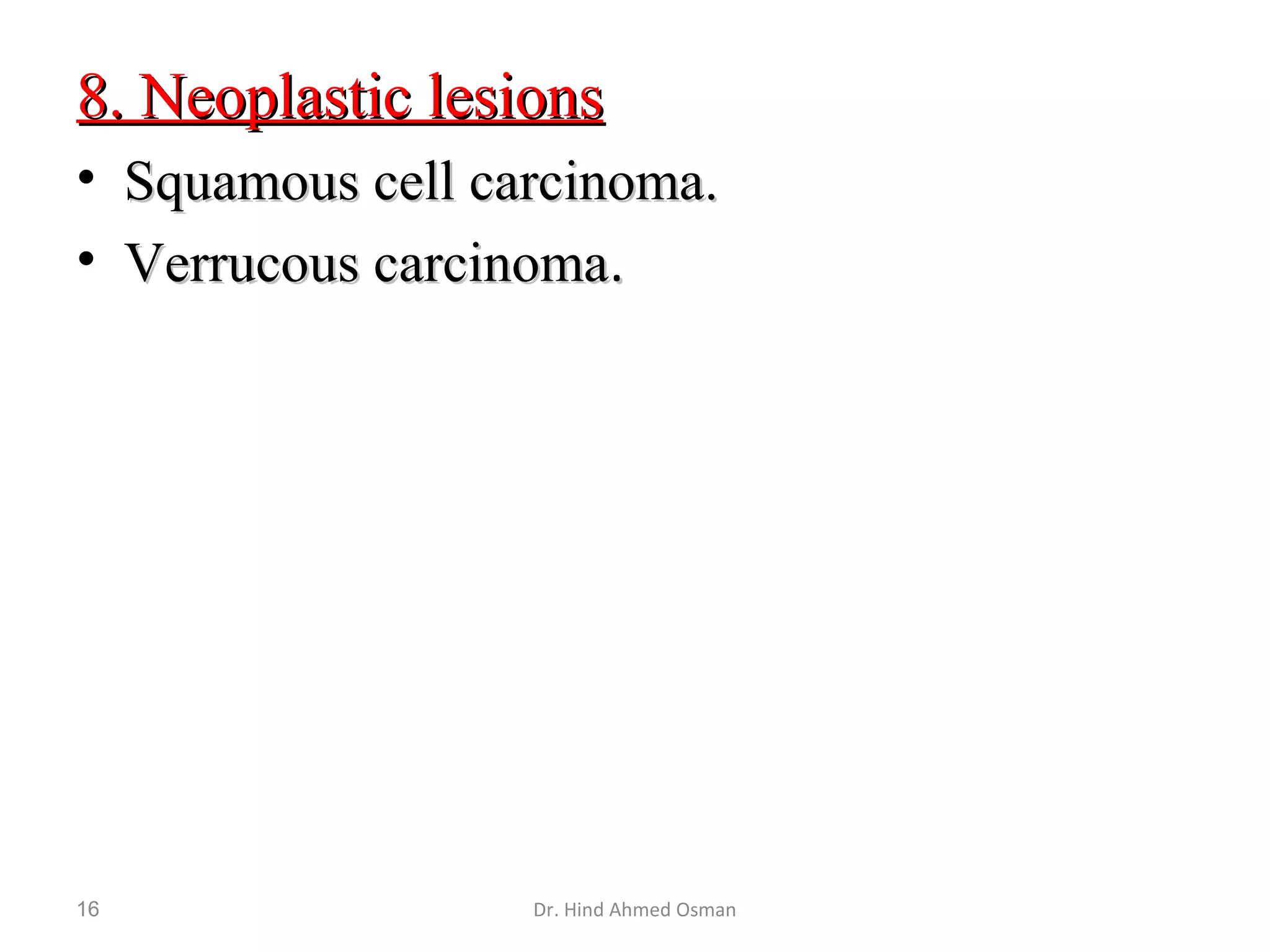 L.16 white lesions and oral keratoses | PPT