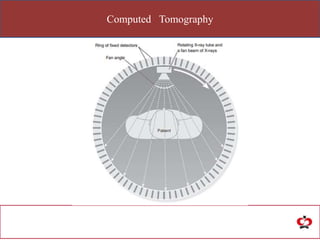 L 1 ct physics | PPT