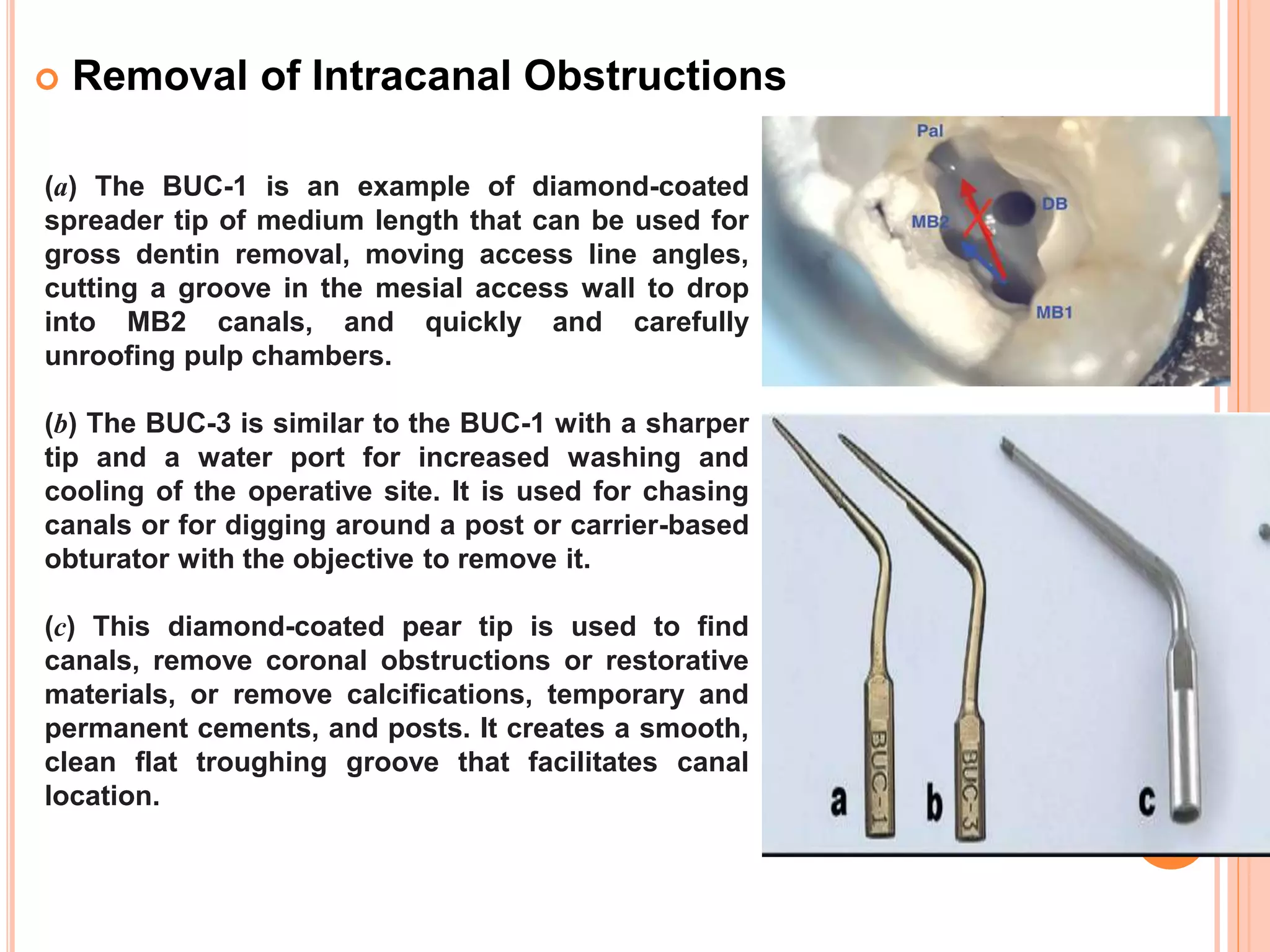 ultrasonic in endodontic | PPTX
