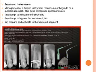 ultrasonic in endodontic | PPTX