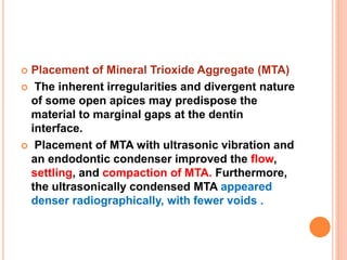 ultrasonic in endodontic | PPTX