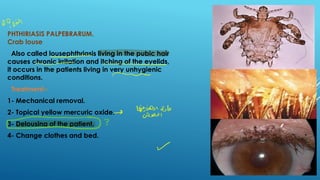 L-2 Eye lid disorder.pdf