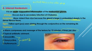 L-2 Eye lid disorder.pdf