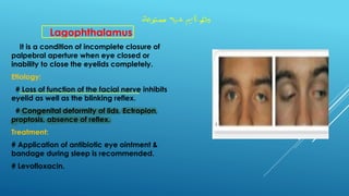 L-2 Eye lid disorder.pdf