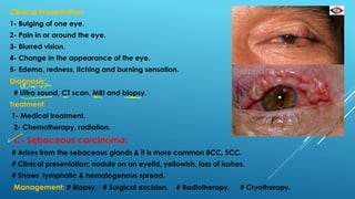 L-2 Eye lid disorder.pdf