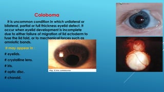 L-2 Eye lid disorder.pdf