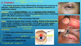 L-2 Eye lid disorder.pdf