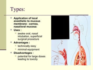 Local Anesthetics(final pre) | PPT