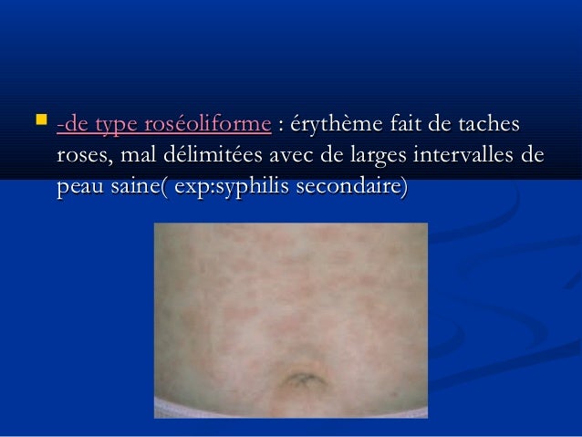 Lésions élémentaires en dermatologie