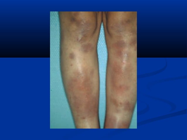 lésions elementaires en dermatologie