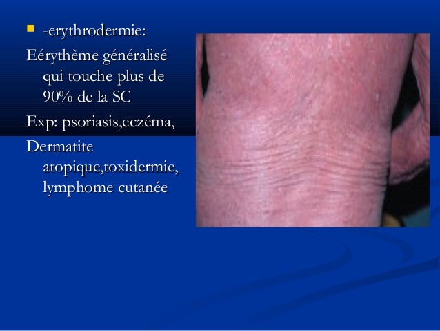 lésions elementaires en dermatologie