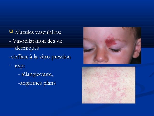 lésions elementaires en dermatologie