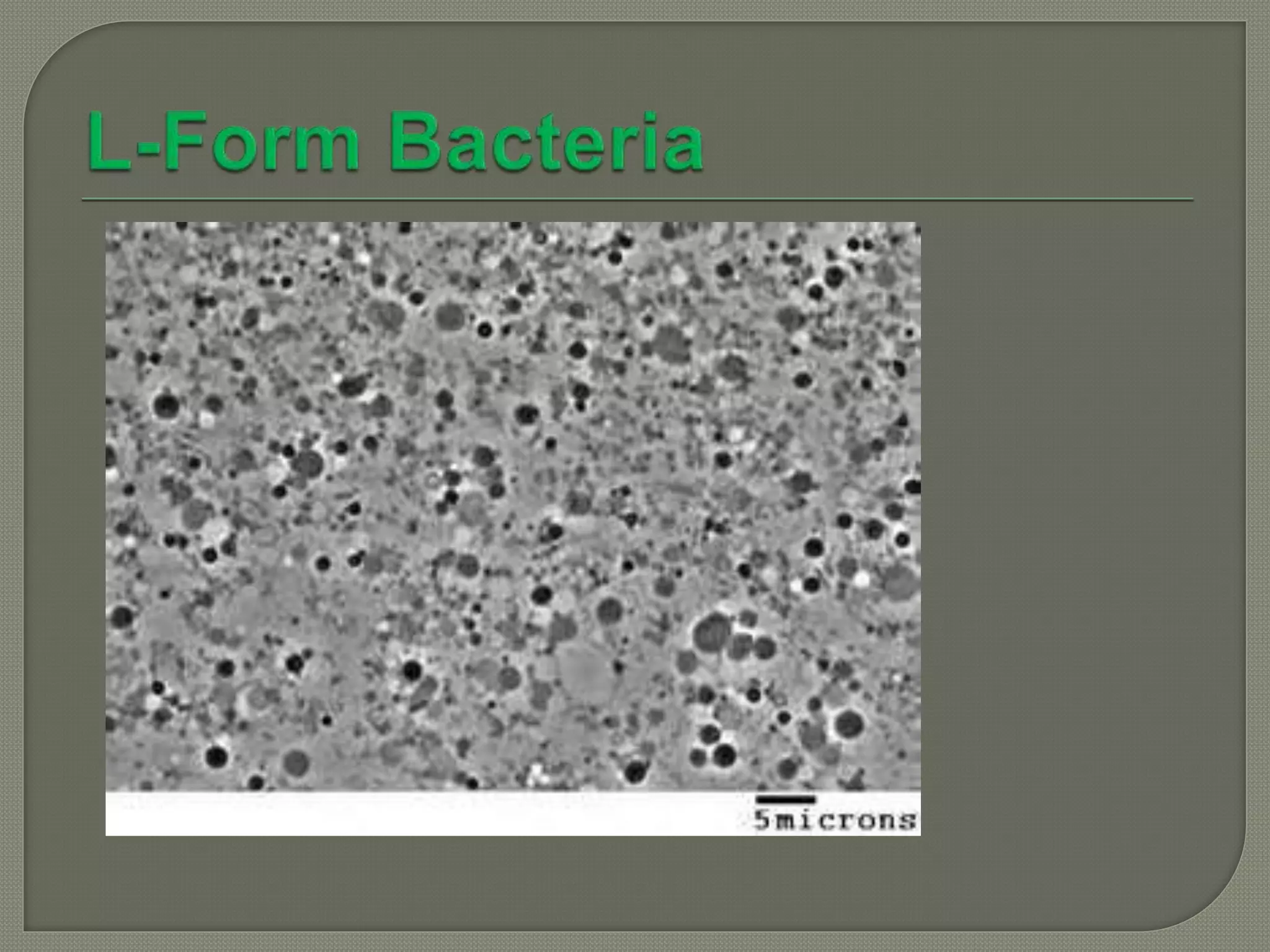 L-forms bacteria, protoplast and spheroplasts Bacteria | PPTX