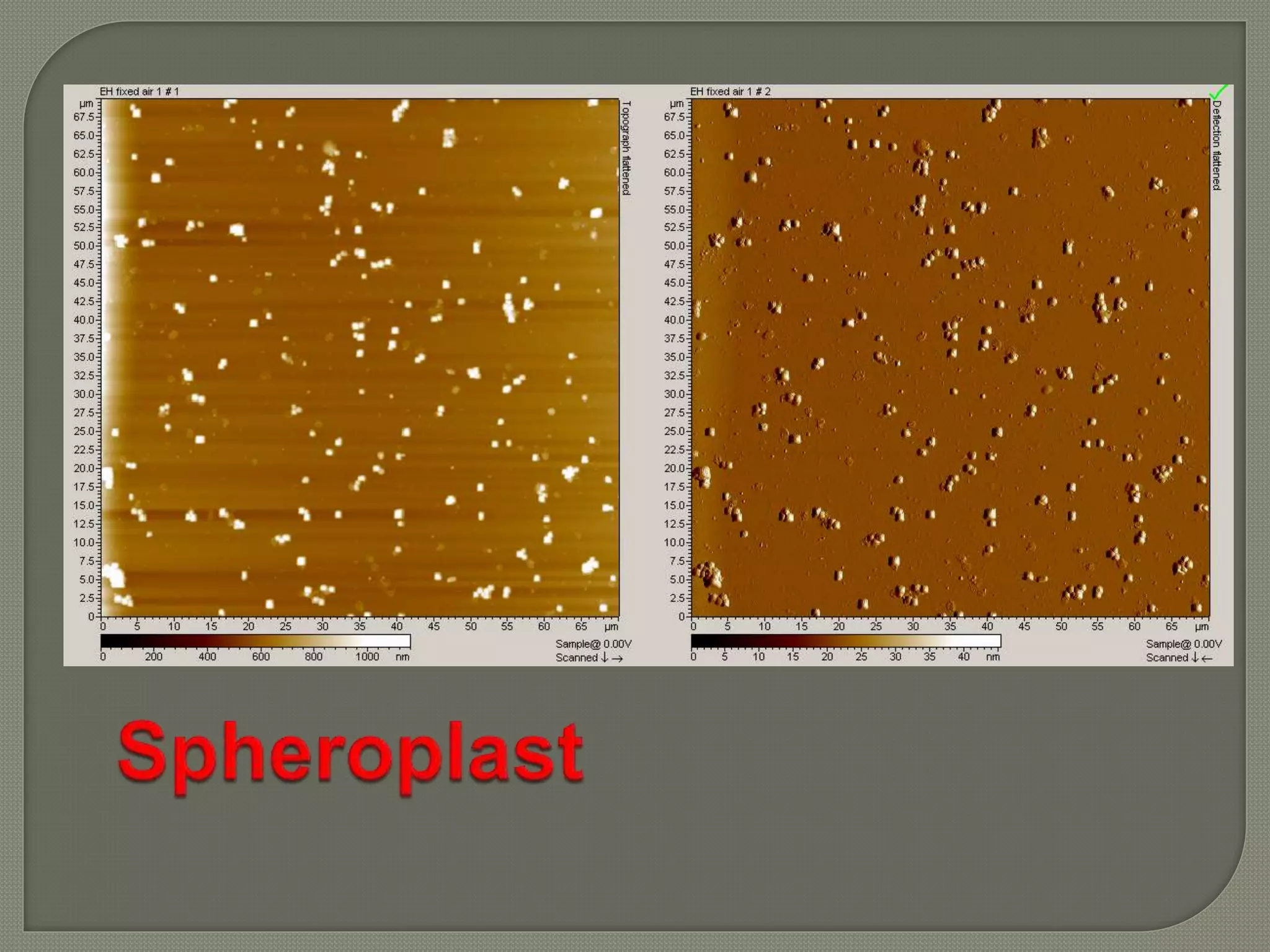 L-forms bacteria, protoplast and spheroplasts Bacteria | PPTX