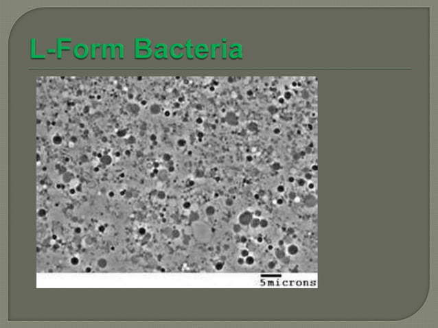 L-forms bacteria, protoplast and spheroplasts Bacteria | PPTX