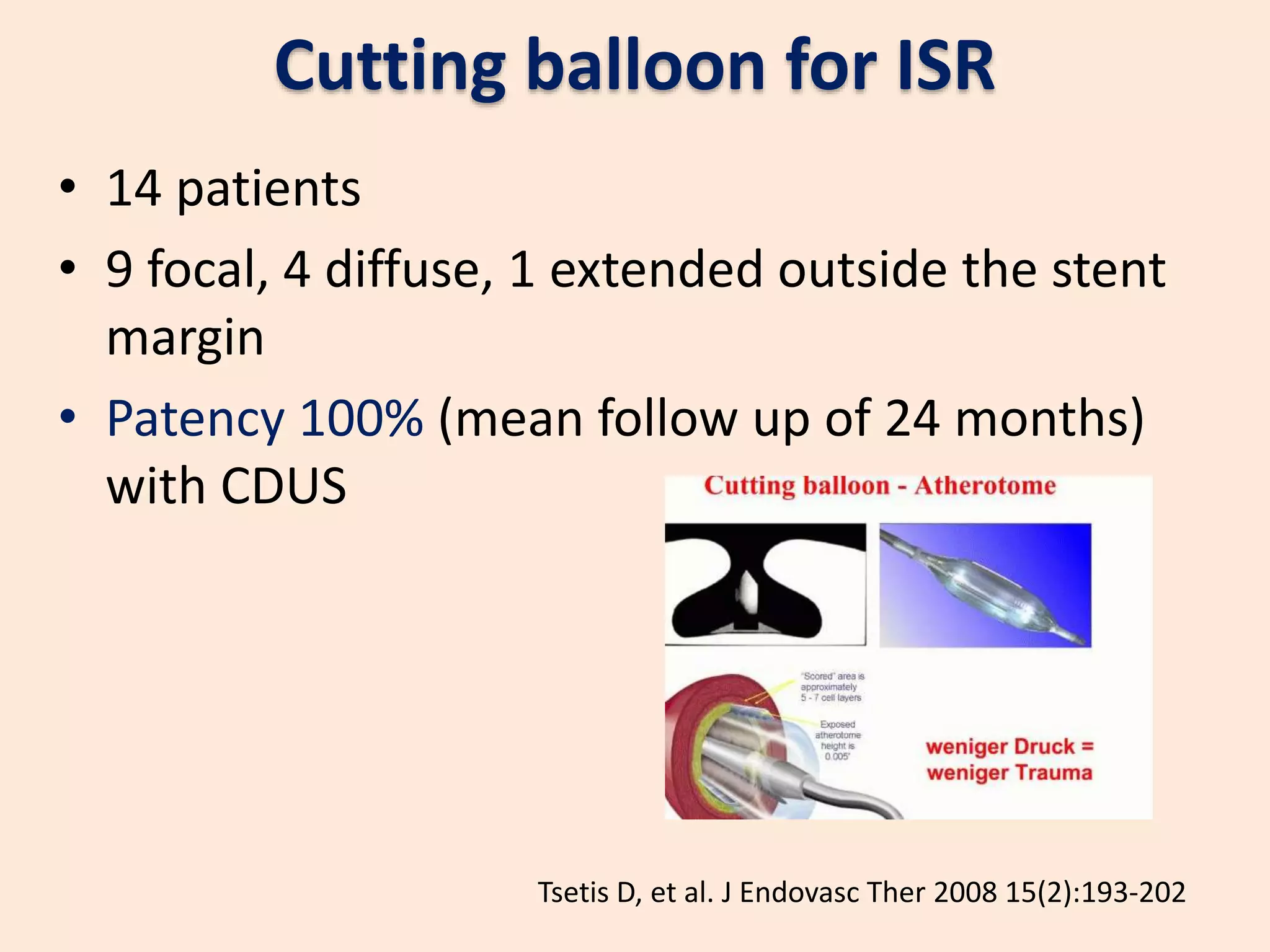 AORTO-ILIAC INTERVENTIONS | PPTX
