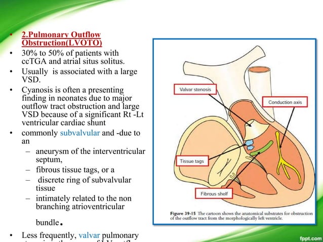 L tga anatomy, management- | PPTX