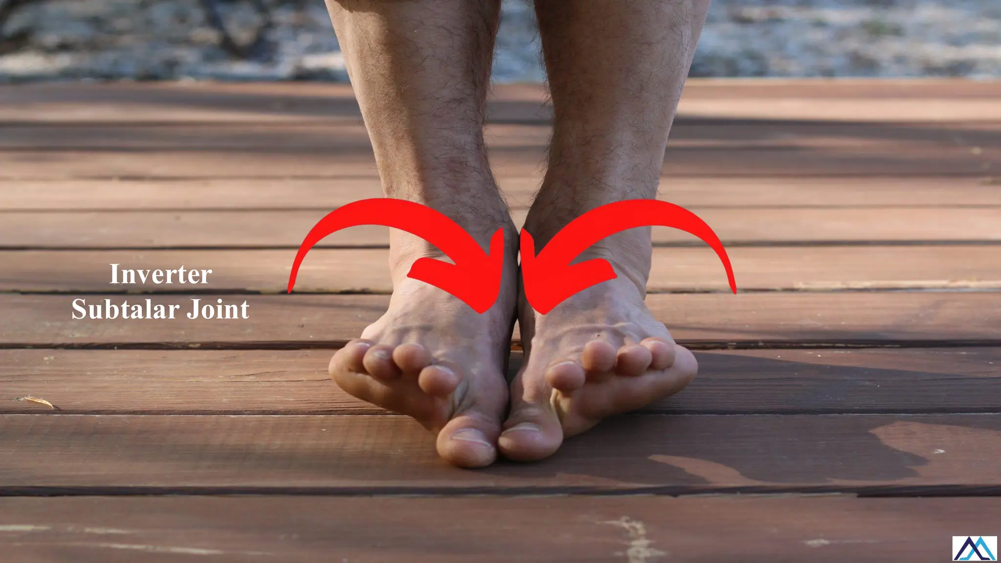 L006 Lower Limb Muscles of leg / Lower Limb Muscles of leg .pdf
