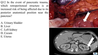 Pancreas / Pancreas / Pancreas / Pancreas.pdf