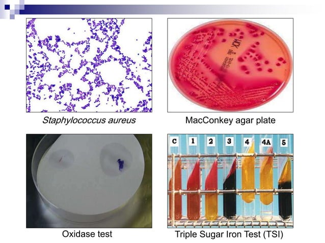 Medical Microbiology Laboratory (introduction & terminology) | PDF ...