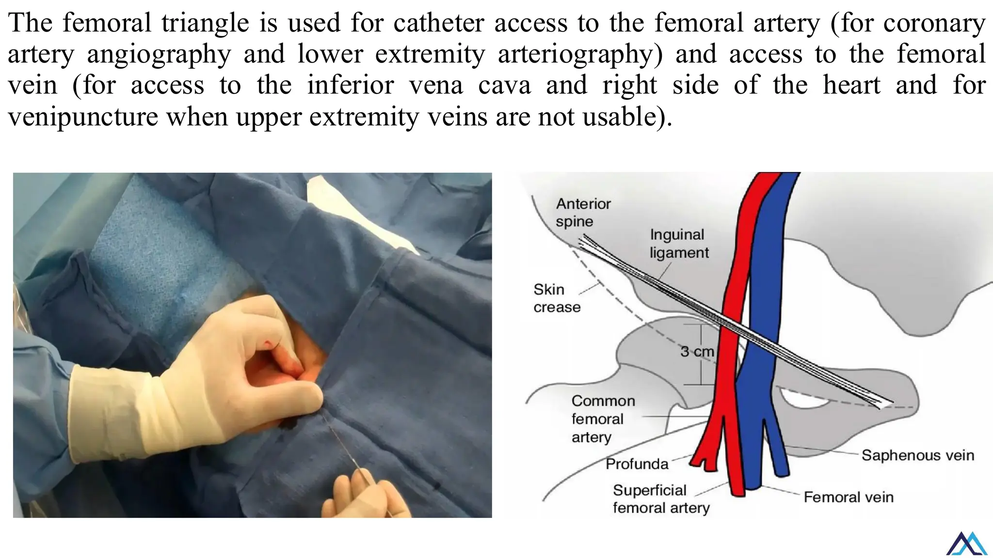 L011 Lower Limb Anatomical regions / Lower Limb Anatomical regions.pdf