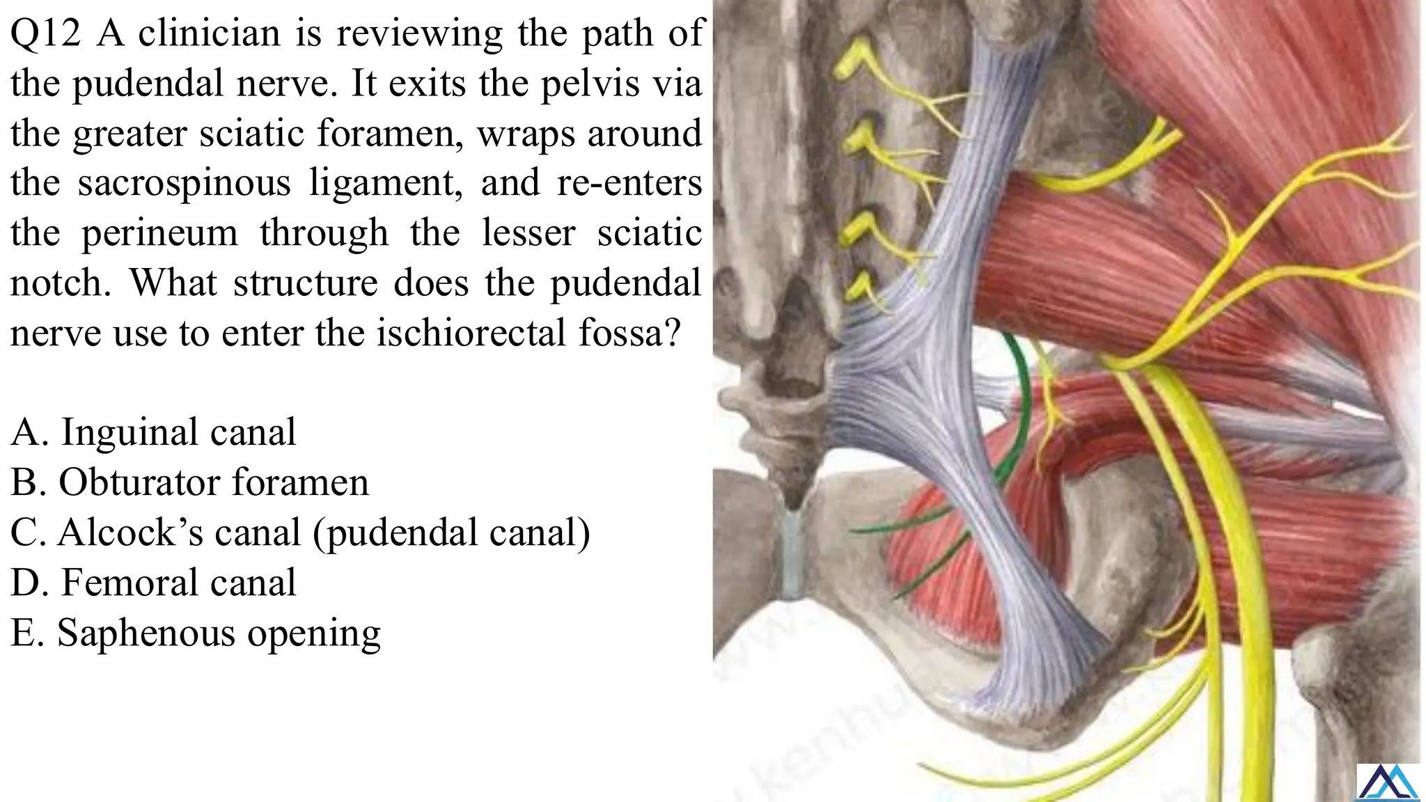 L011 Lower Limb Anatomical regions / Lower Limb Anatomical regions.pdf