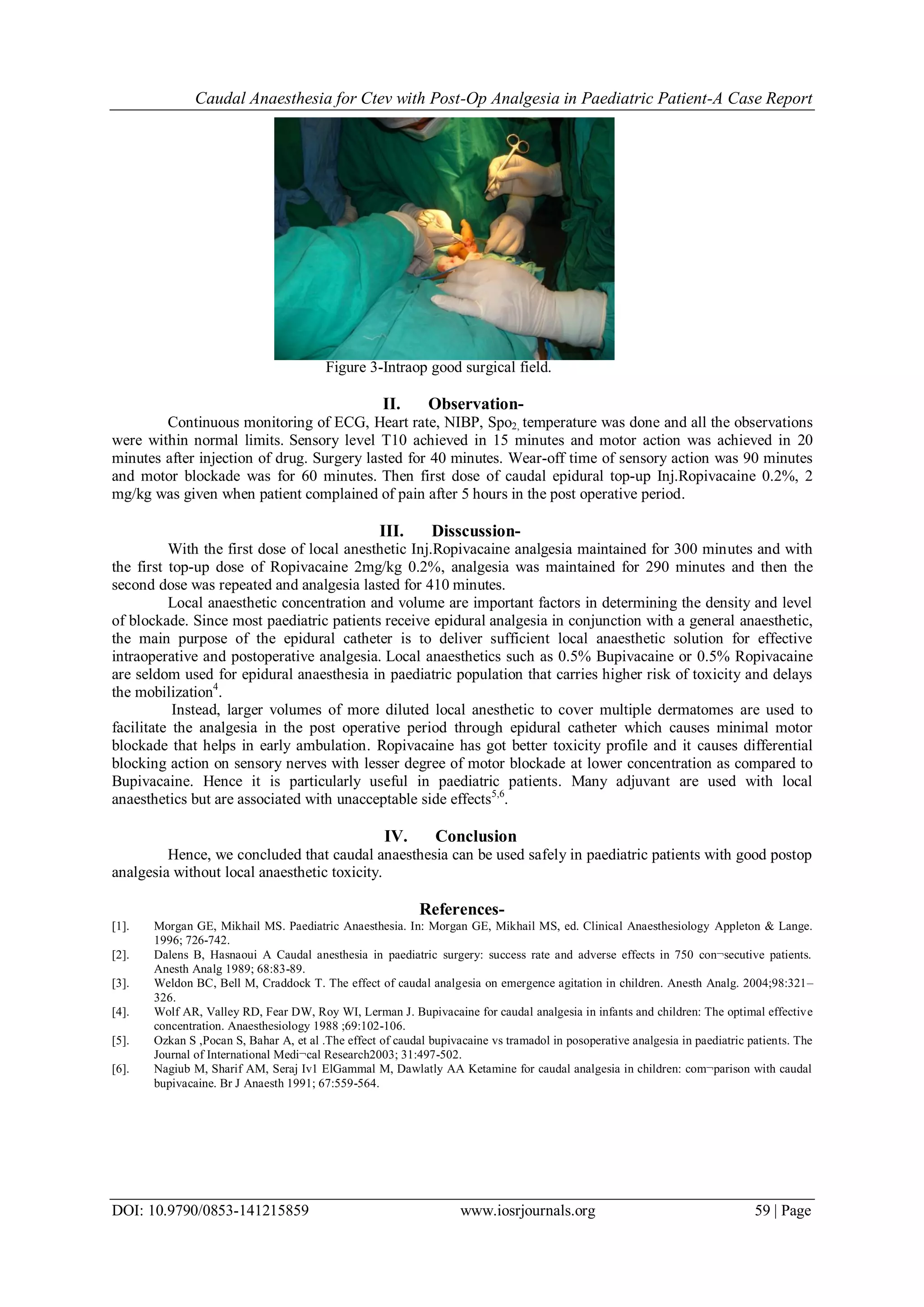 Caudal Anaesthesia for CTEV with Post-Op Analgesia in Paediatric ...