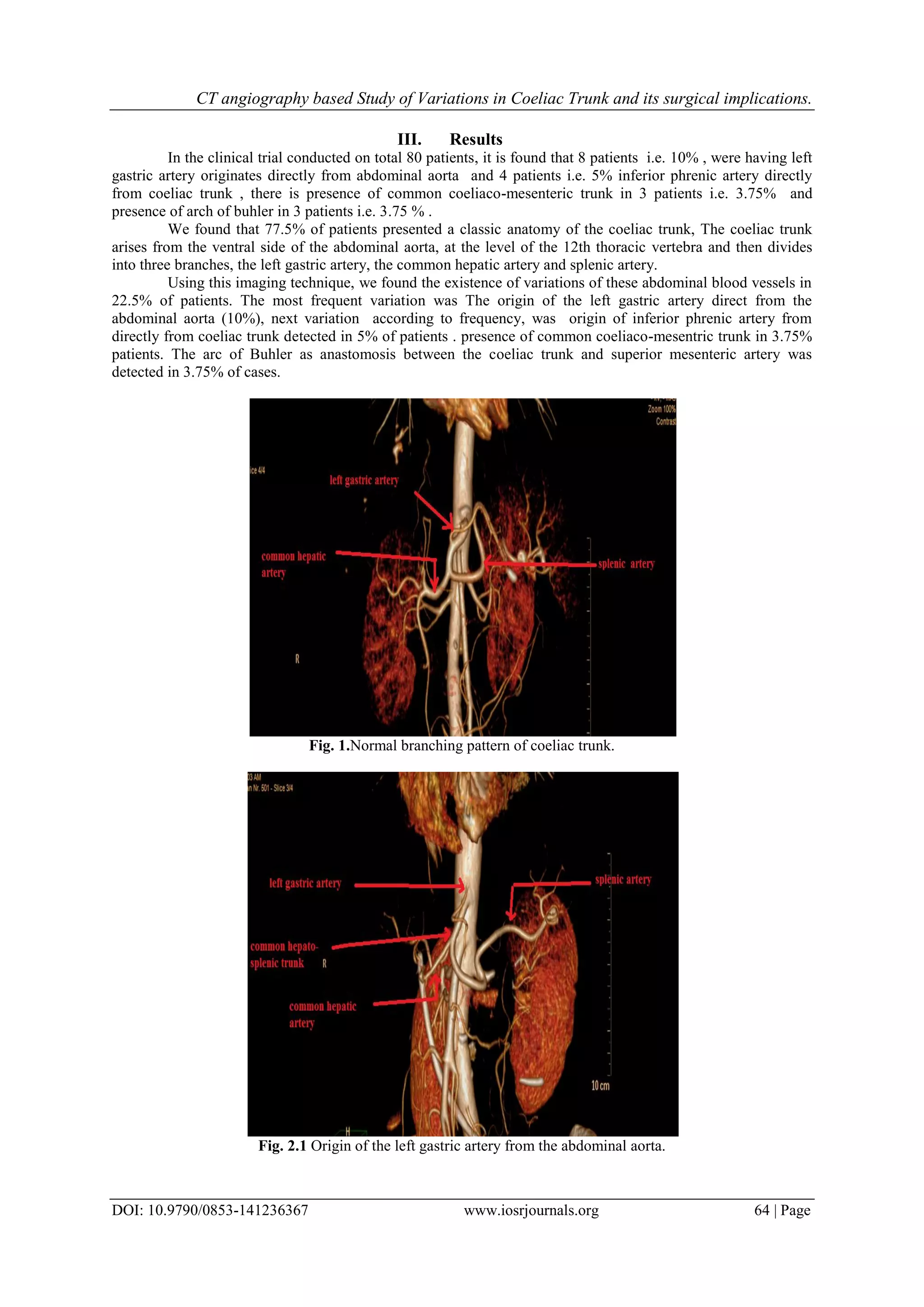 CT angiography based Study of Variations in Coeliac Trunk and its ...
