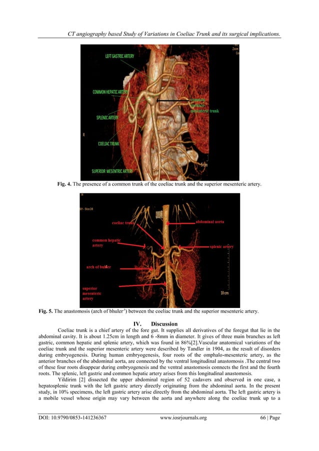 CT angiography based Study of Variations in Coeliac Trunk and its ...