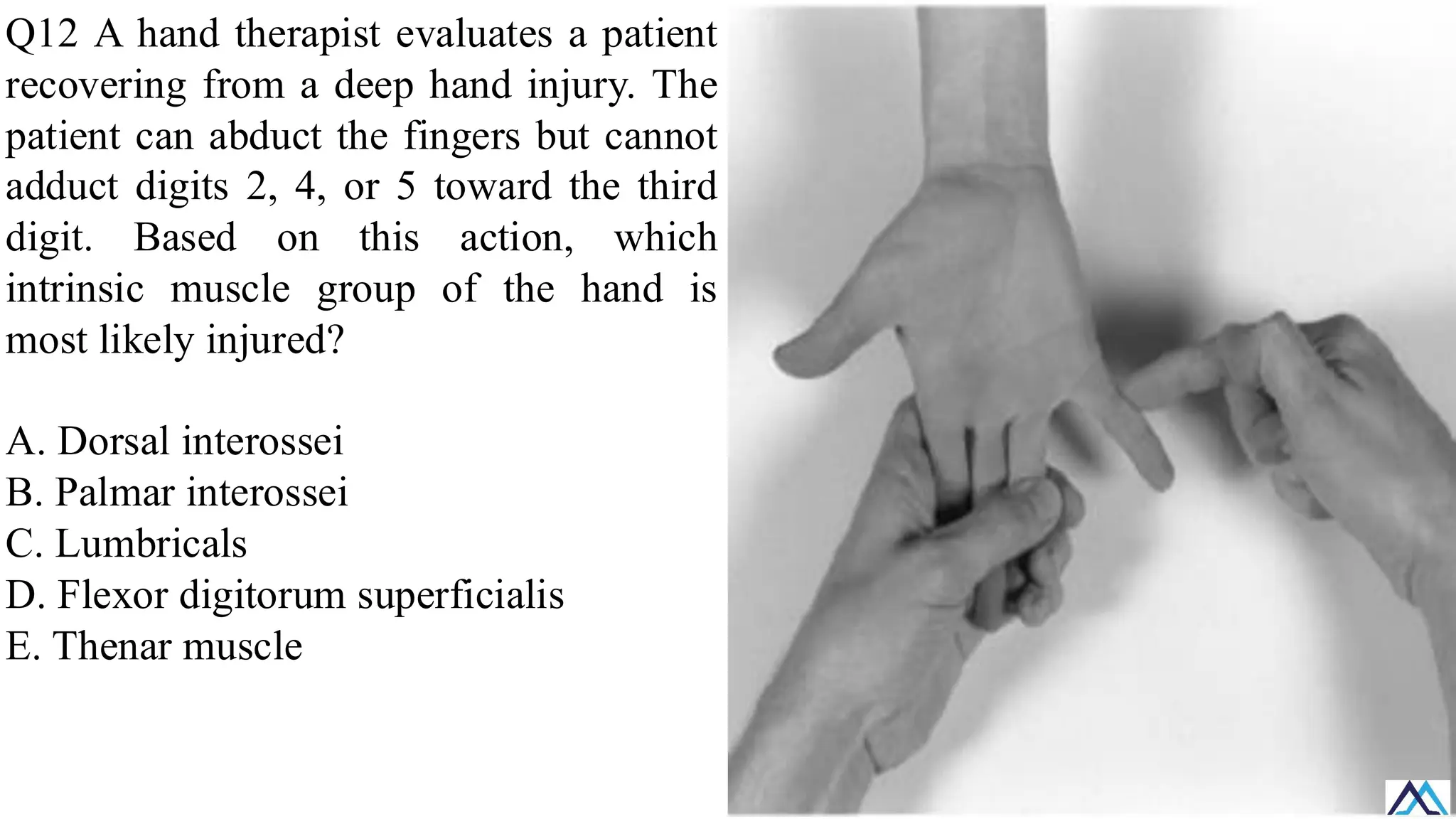 L016 Upper Limb Muscles of hand / Upper Limb Muscles of hand / Upper ...