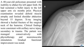 L017 Upper Limb Joints / Upper Limb Joints / Upper Limb Joints.pdf