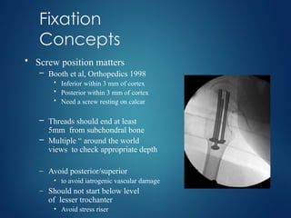 Femoral Neck Fractures presentation .pptx