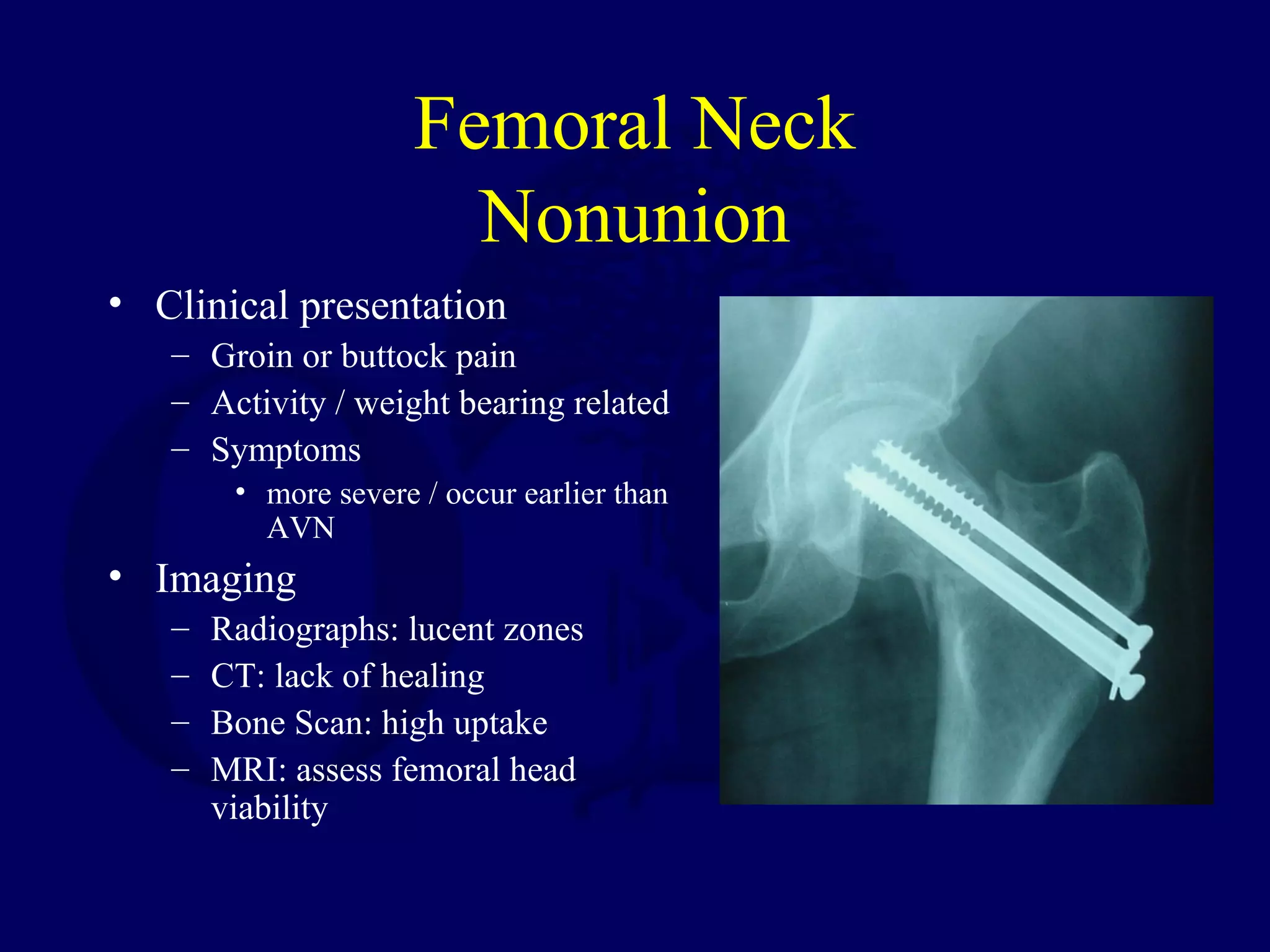 L02 femoral neck fx | PPT