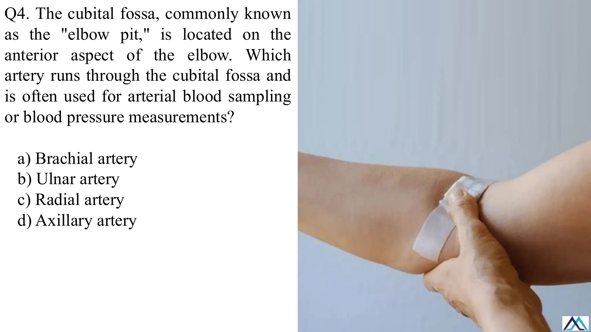 L020 Upper Limb Anatomical regions / Upper Limb Anatomical regions ...