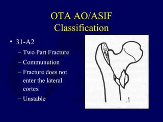 L03 intertrochanteric fx | PPT