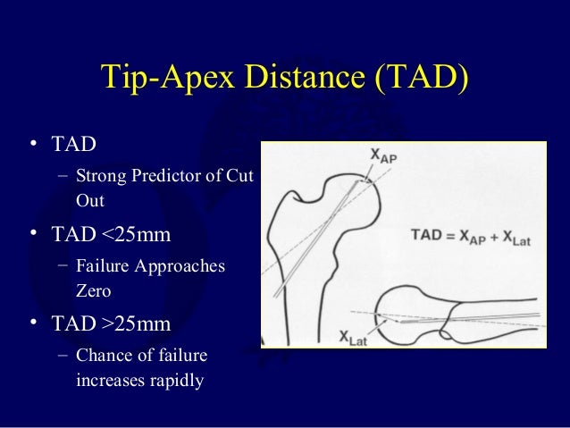 L03 intertrochanteric fx