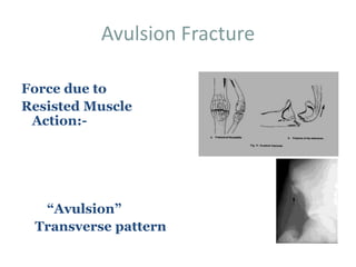 L03-Introduction to orthopaedics.ppt.intro | PPT