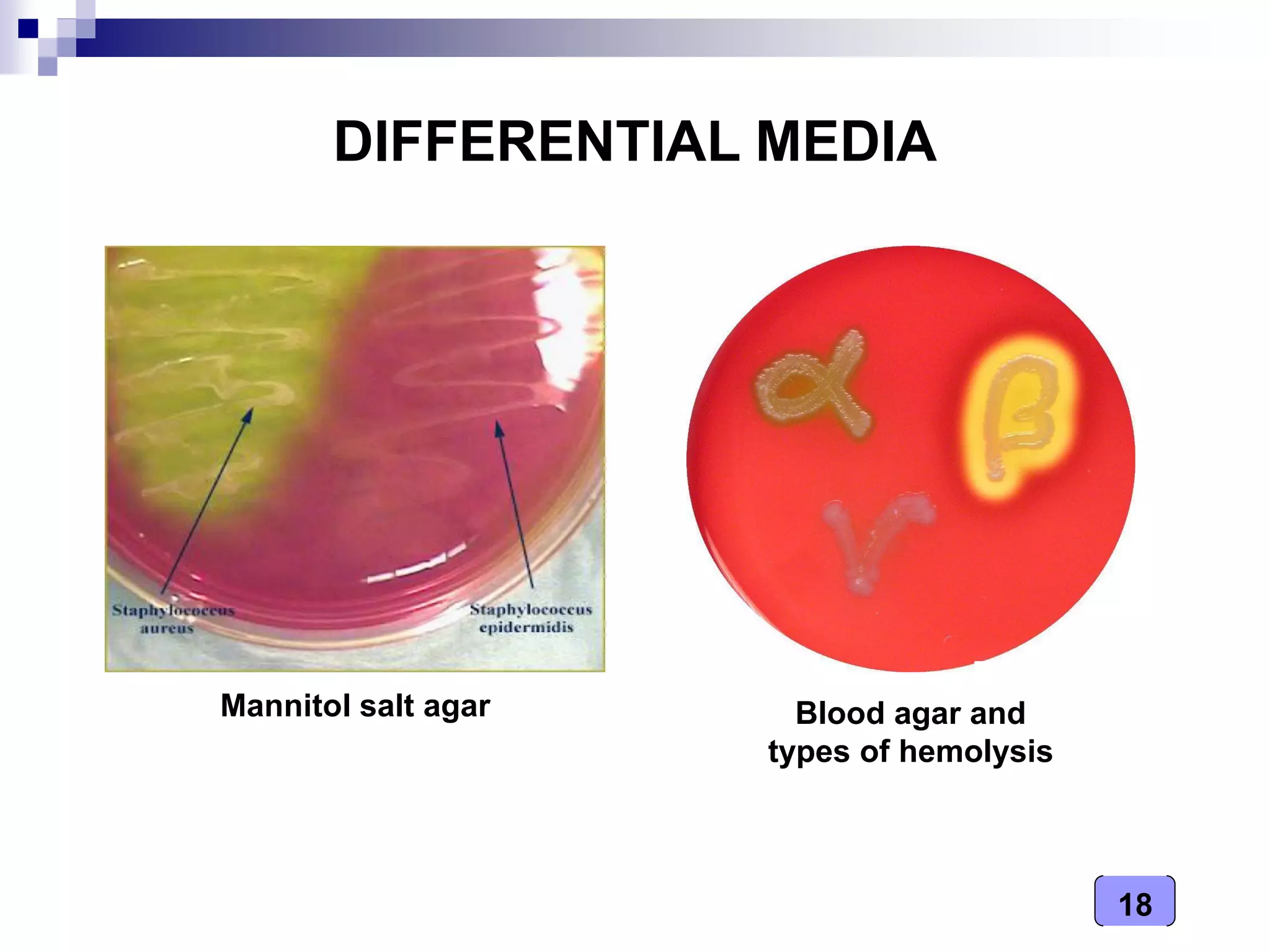 Medical Microbiology Laboratory (culture media classification) | PDF