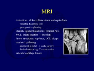 L06 knee dislocations | PPT