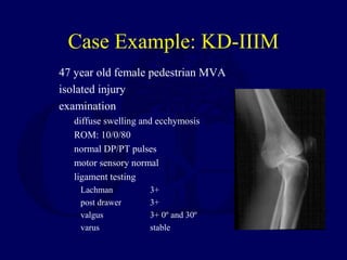 L06 knee dislocations | PPT